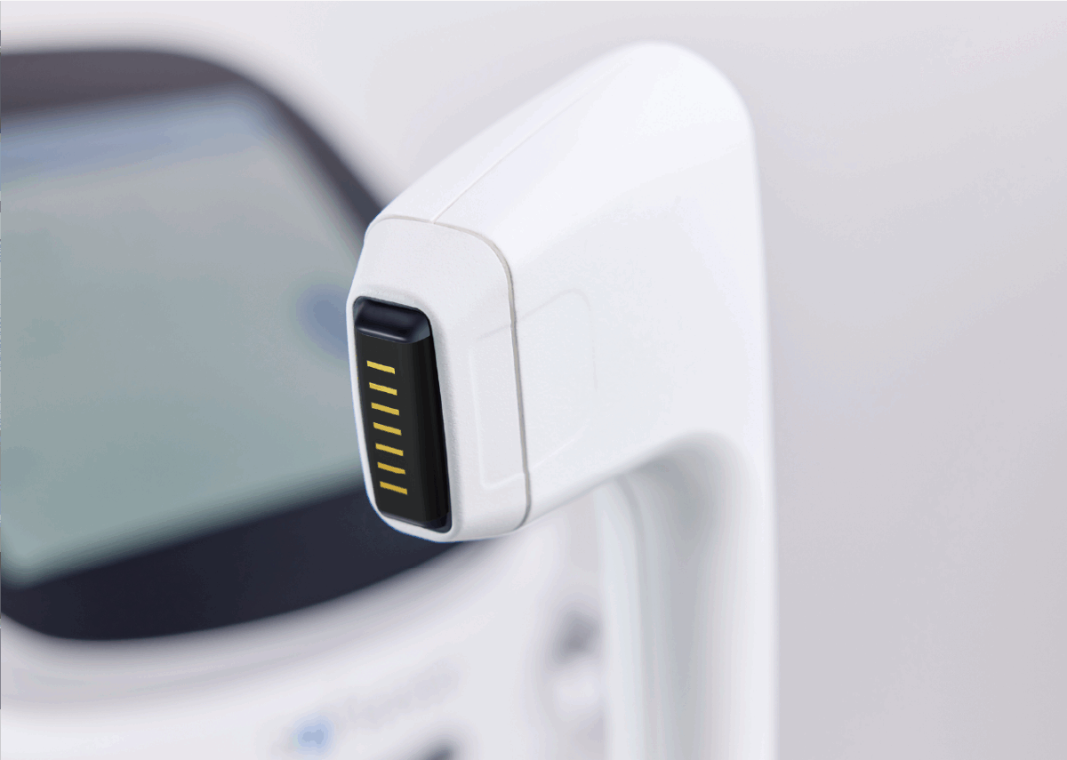 【顔面・頚部のしわ】Sofwave | JMEC WEB SHOWROOM